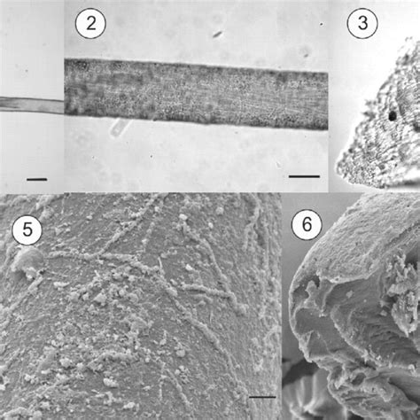 Photomicrograph Of Fossil Hair Obtained By Optical Microscope 1 3 Download Scientific Photomicrograph Of Fossil Hair Obtained By Optical Microscope 1 3 Download Scientific