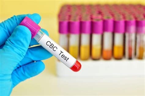 Complete Blood Count CBC Familydoctor Org