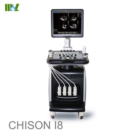 Ultrasonido Abdominal Chison I8 Ultrasonido 4d Doppler Obstetrico
