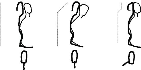 Sketch Of Headrest Configuration Alternatives To Correct For A Download Scientific Diagram