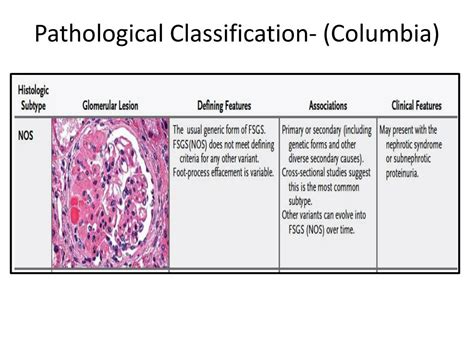 Ppt Focal Segmental Glomerulosclerosis Powerpoint Presentation Free