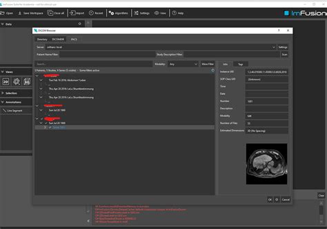 Problems Retrieving Image Data From Pacs Imfusion Suite Imfusion