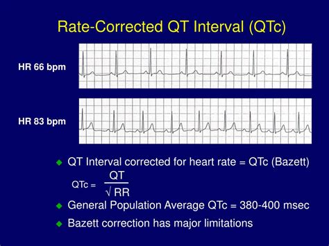 Qtcf Interval