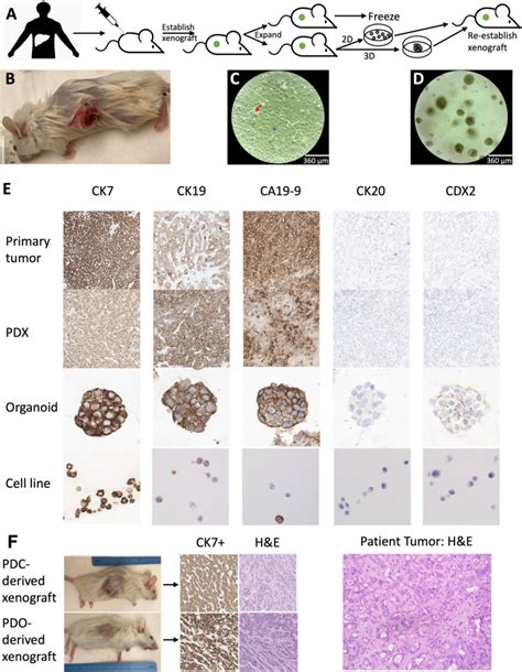 Leveraging Patient Derived Models Of Fgfr2 Fusion Positive Intrahepatic