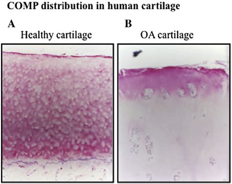 Figure 3 From Cartilage Oligomeric Matrix Protein And Its Binding Partners In The Cartilage