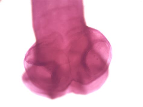 Tapeworm Scolex Slide Prepared Slides