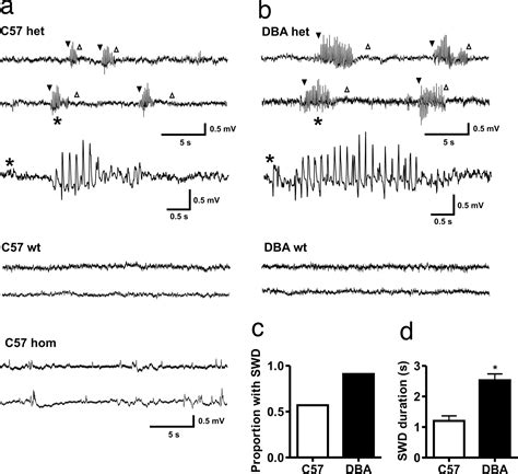 Absence Seizures Eeg