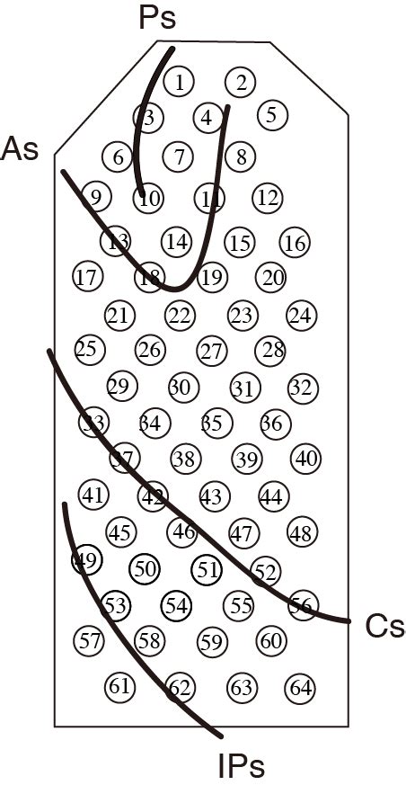 Epidural Ecog Food Tracking Task