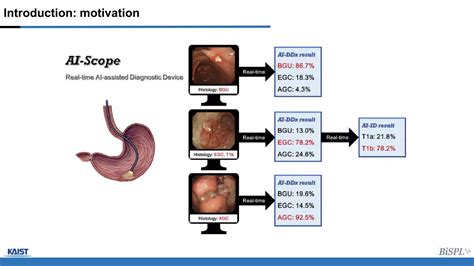 A Deep Learning Model For Diagnosing Gastric Mucosal Lesions Using