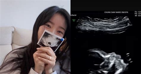 ‘결혼 4년만 임신 배슬기 벌써 아들 자랑 “옆선 미쳤네