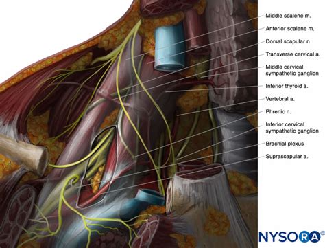 Ultrasound Guided Interscalene Brachial Plexus Nerve Block NYSORA