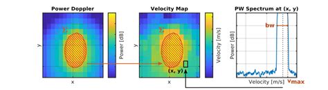 Schematic Representation Of The Flow Rate Estimation Procedure The