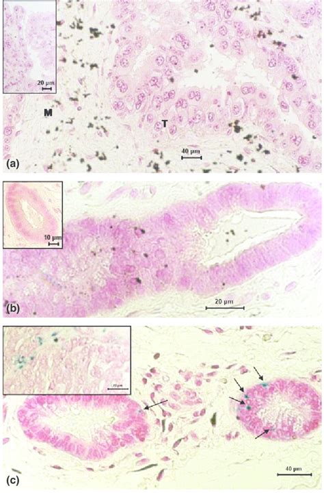 A B Photomicrographs Of The Acid Phosphatase Reaction The Insets