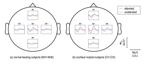 Mean Temporal Response Functions Trfs Recorded Through Scalp