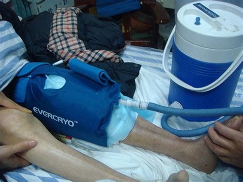 Recovery Time For Acl Surgery Timeline Tips And Faqs R Acl