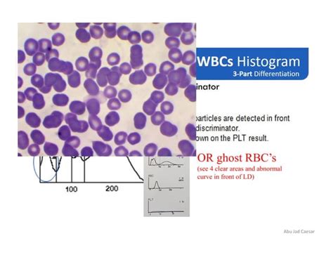 Wbc Histogram