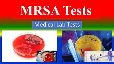 Mrsa Tests Medical Lab Tests What Is Uses Need