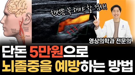 가성비 최강 혈관 검사 L 경동맥 초음파에 대한 모든 것 닥터인사이드 Youtube