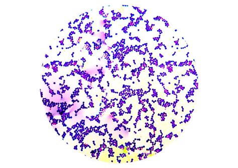 10 Streptococcus Viridans Fotos Stockfotos Afbeeldingen En Royalty Free Beelden Istock