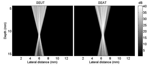 Acoustic Beam Patterns Of The Seut And Seat Download Scientific Diagram