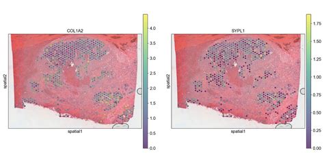 单细胞空间转录组分析流程学习python版三python 空间转录组 Csdn博客