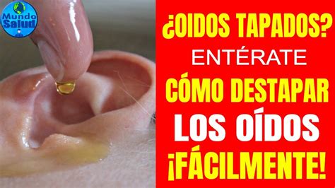 Cómo Limpiar Cera De Oídos Del Bebé 【2026 】 ️ Bricolaje
