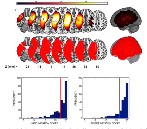 Figure 1 From Using Multi Level Bayesian Lesion Symptom Mapping To Probe The Body Part