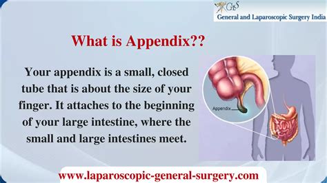 Appendix Removal Surgery In Bangalore Laparoscopic Appendicitis