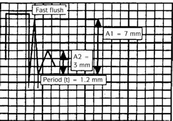 BP Monitoring And Oximetry Flashcards Quizlet