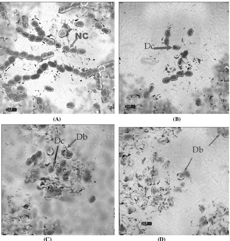Transmission Electron Microscope Of Streptococcus Group B The Causal