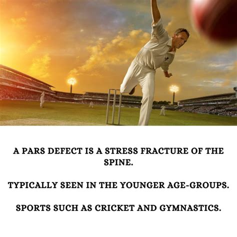 Pars Defect And The Impact On Younger Cricket Bowlers And Gymnasts