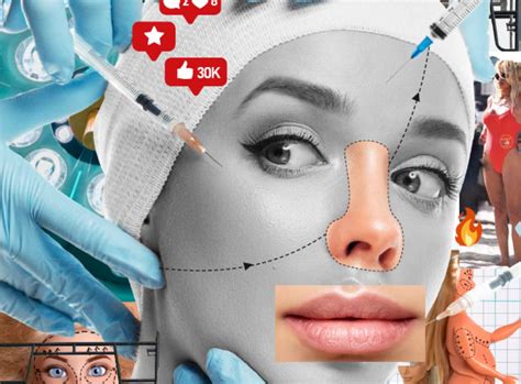 Inside The Shocking New Cosmetic Surgery Trends