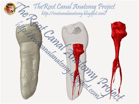 The Root Canal Anatomy Project C Shaped Mandibular First Premolar