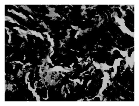 Color Segmentation For Figure 2a Part 1 A The Hue Component Of Download Scientific