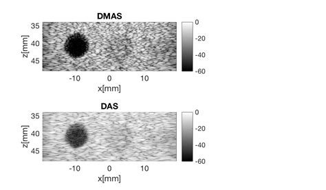 Contrast Of Delay Multiply And Sum On Fi Data From An Uff File