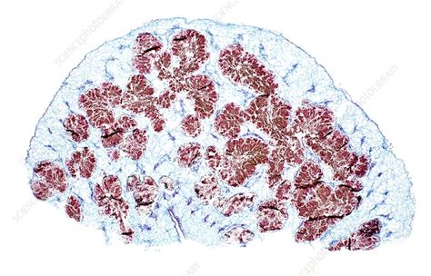 Corn Smut Infection Light Micrograph Stock Image C0116353