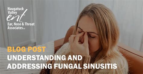 Fungal Sinusitis Understanding And Addressing Fungal Sinusitis In
