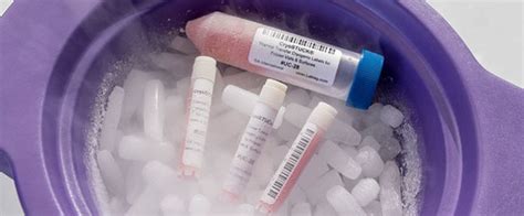 How Long Can You Store Samples In The Freezer Labtag Blog