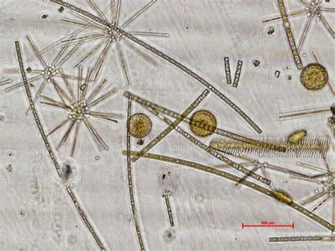 Ulothrix Is A Genus Of Filamentous Green Algae Fragilaria Cyclotella