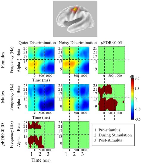 Sex Differences In Early Sensorimotor Processing For Speech Discrimination Scientific Reports