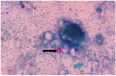 Oocyst Of Cryptosporidium Under 400 X Magnification Modified Zn Download Scientific Diagram