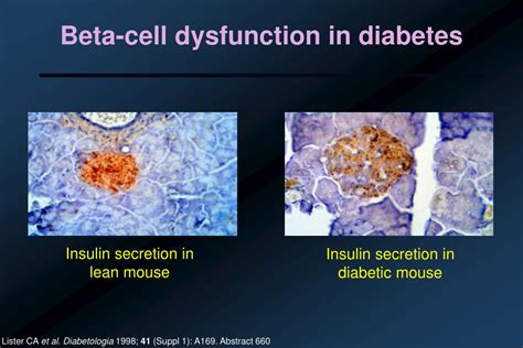 Ppt Conditions Associated With Insulin Resistance Powerpoint Presentation Id 5829271