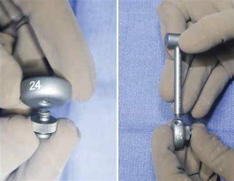 Align® Radial Head System Implants Orthobullets