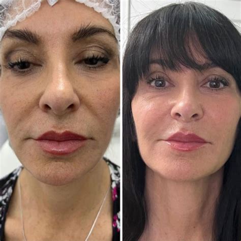 Regenerative Medicine Eternal Beauty Medical Centre