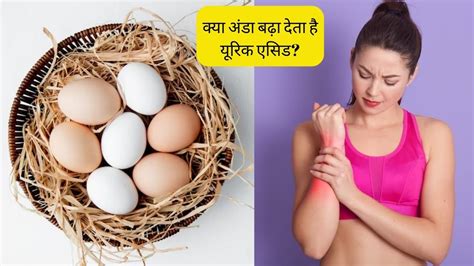 Does Eating Eggs Increase Uric Acid Levels Know How Dangerous Is For Gout And Arthritis Eggs