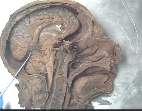 Diagram Of Cisterns Quizlet