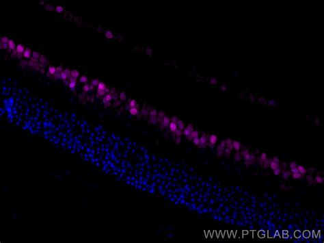 Pax6 Antibody Cl647 12323 Proteintech 武汉三鹰生物技术有限公司