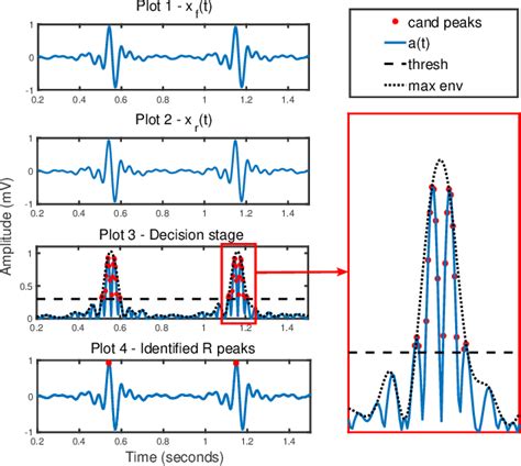 Figure 11 From Ecg Derived Respiration Using A Real Time Qrs Detector Based On Empirical Mode