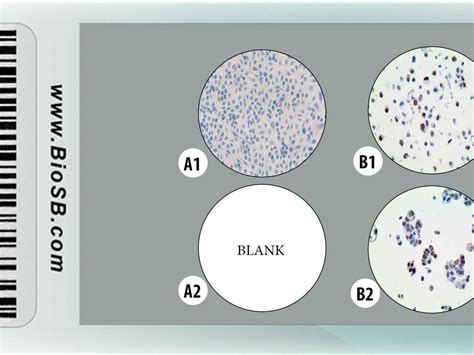 7 Core Hpv Cervical Cancer Cell Line Microarray Bio Sb