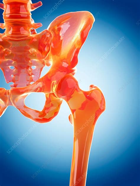 Human Hip Joint Stock Image F016 2828 Science Photo Library